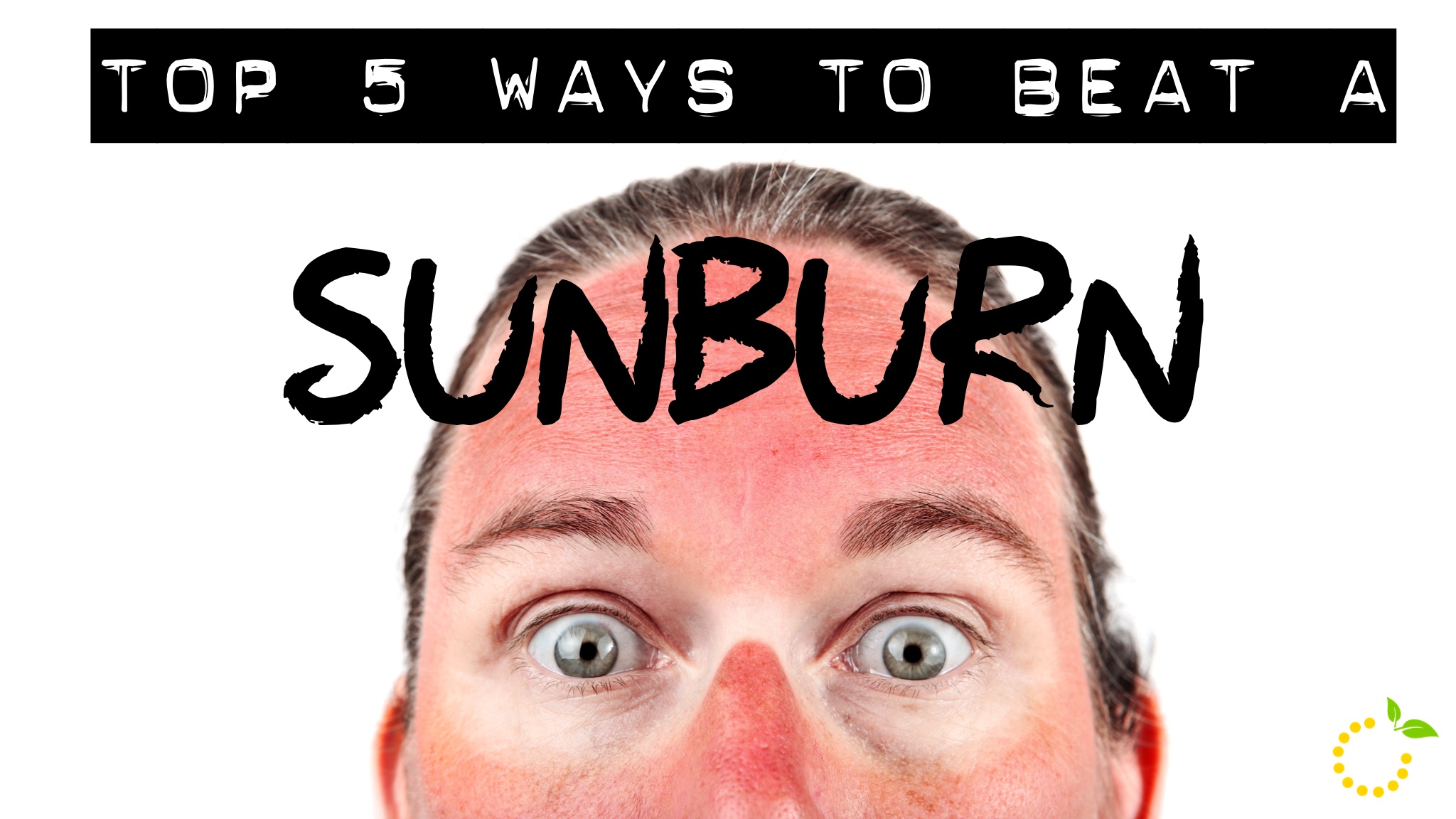 Top 5 Ways to Beat a Sunburn · Sweet Lemon Made